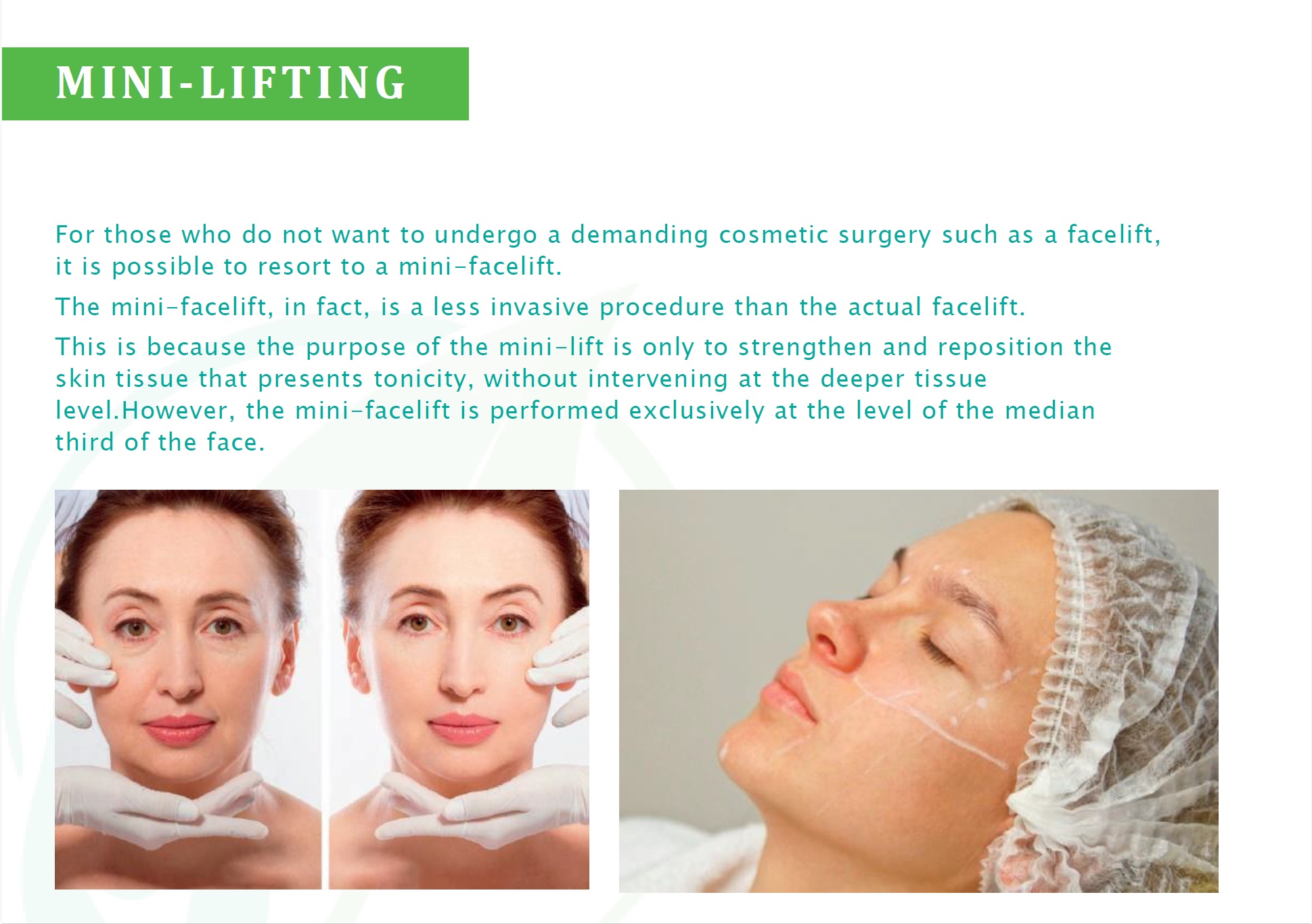 Mini-Lifting – International Family Hospital